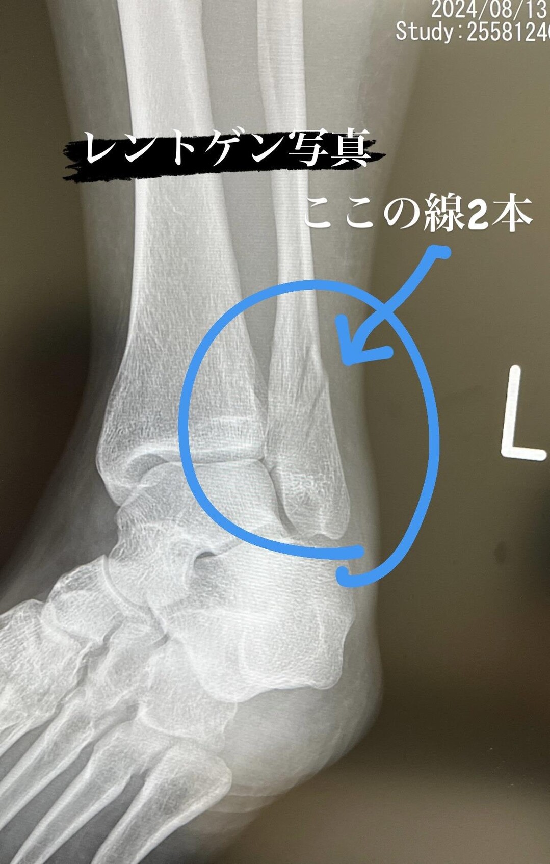 2024.08.11 山の日⛰️ 念願... / なみこさんのモーメント | YAMAP / ヤマップ