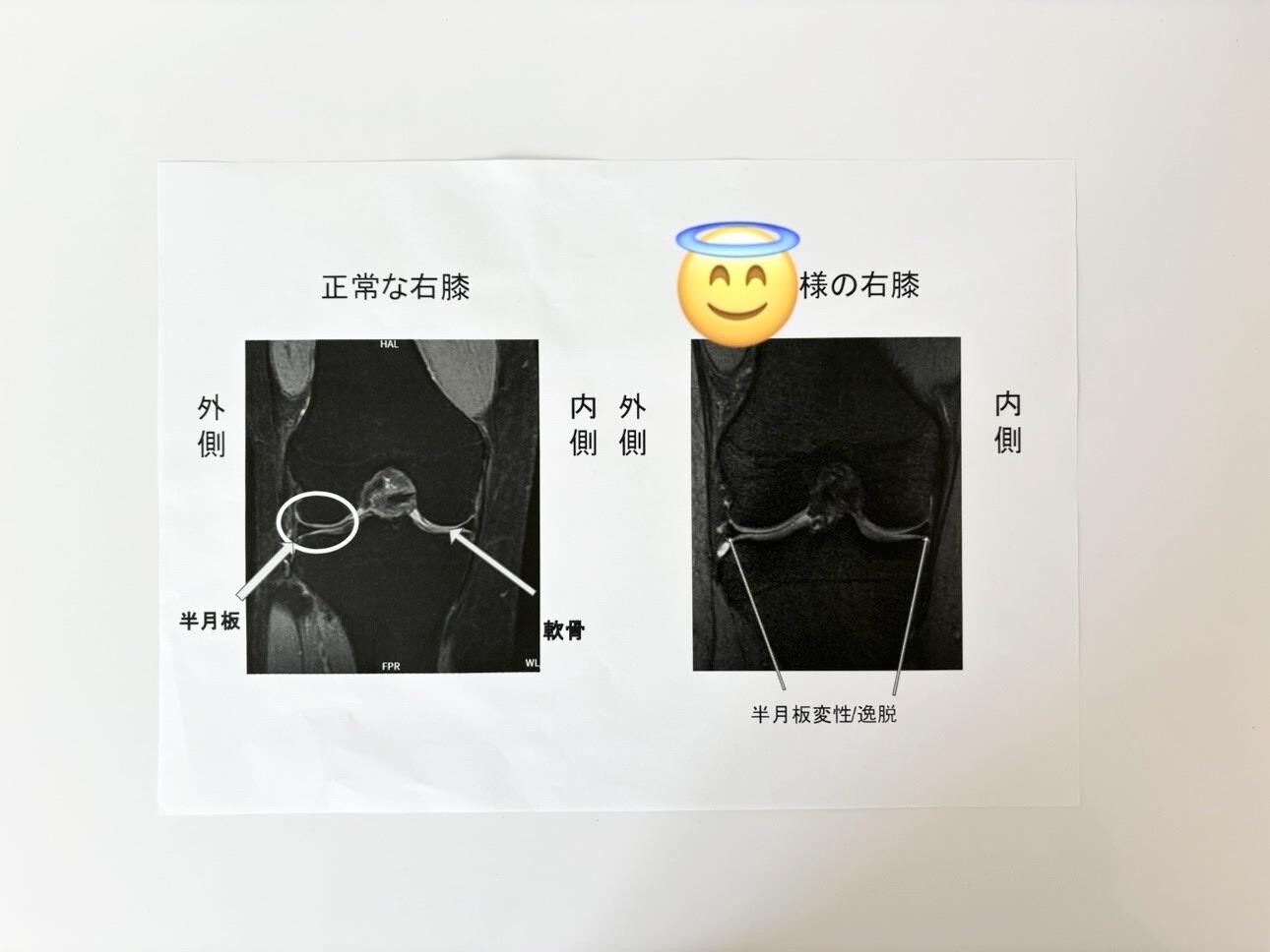 【右膝診断】 これまでとは異なる膝痛を感... / Aokoさんのモーメント | YAMAP / ヤマップ