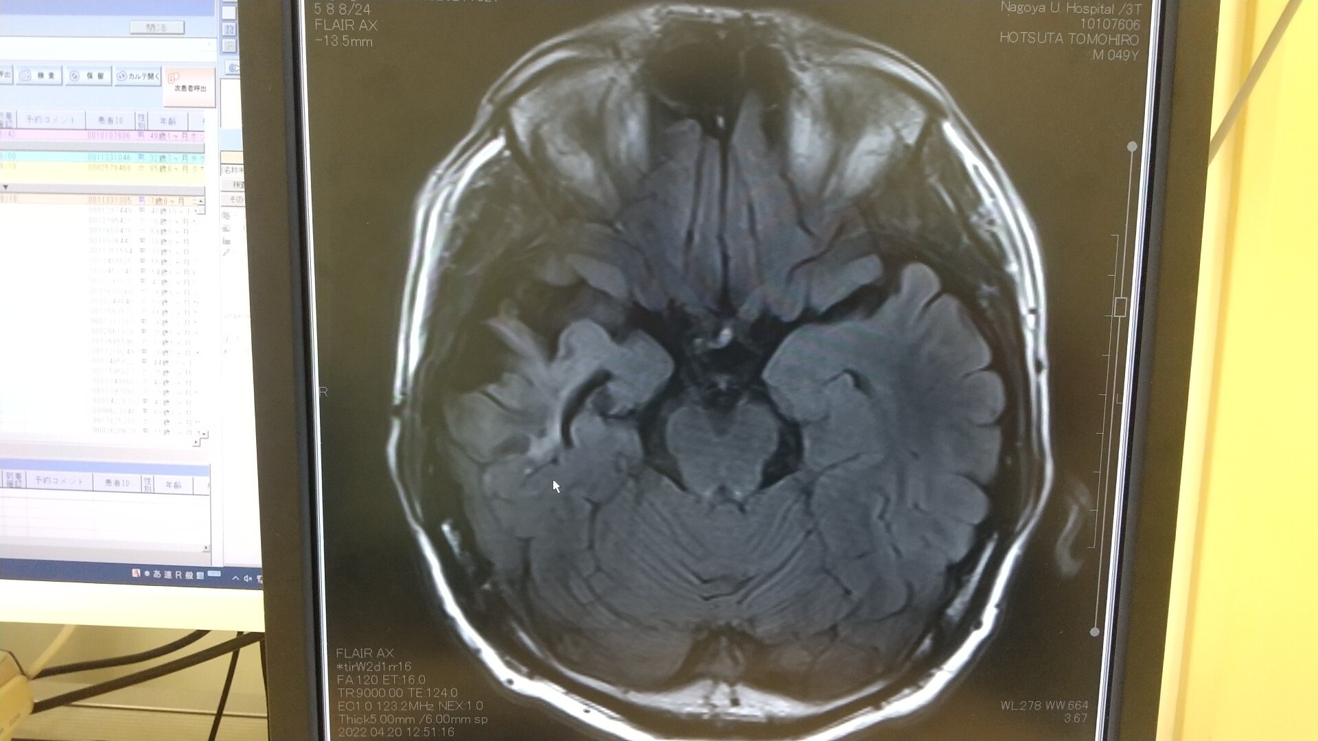 今日は、名大病院で先週、撮ったMRIの ... / hottyさんのモーメント | YAMAP / ヤマップ