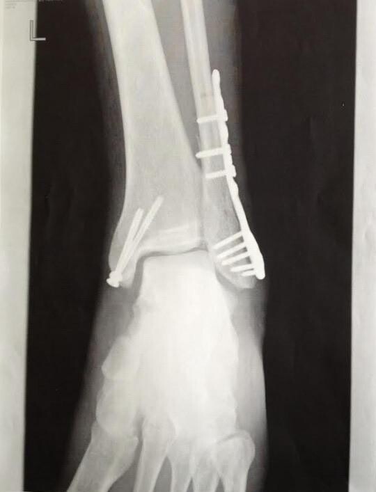 2012年4月の苦い思い出 / deuterさんのモーメント | YAMAP / ヤマップ