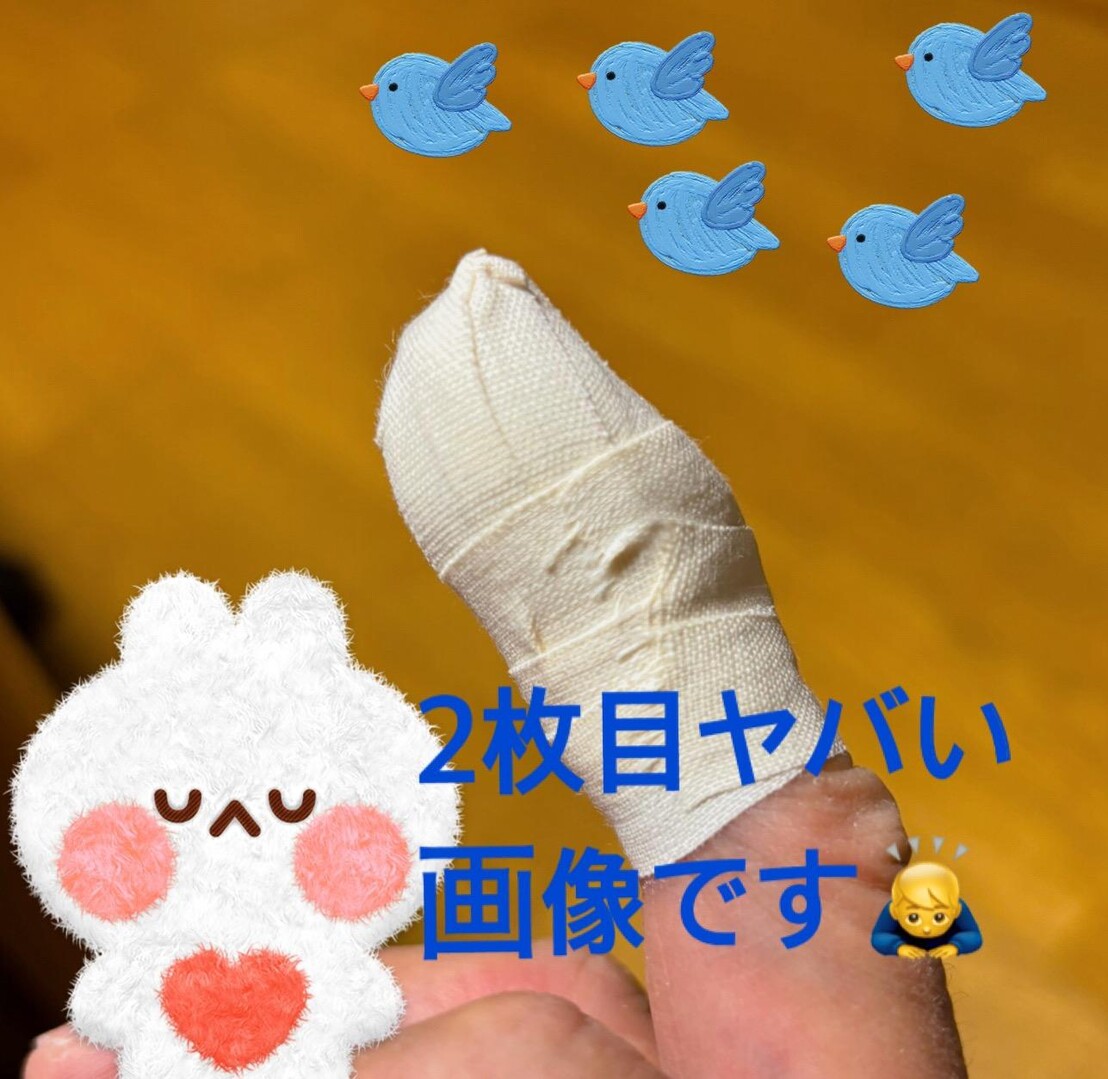 土曜にクライミングでやっちまったヤツ ま... / GanjaEX🐕さんのモーメント | YAMAP / ヤマップ