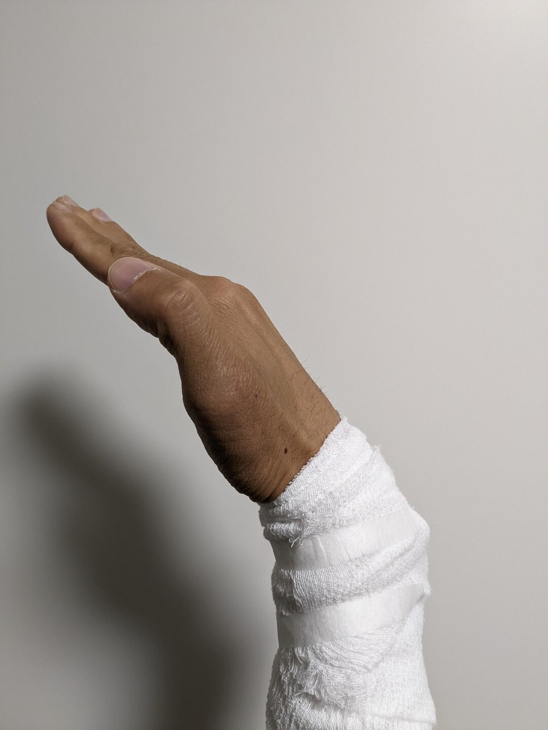 「こちやまのリハビリ録 #2」 どうも... / こちやまさんのモーメント | YAMAP / ヤマップ