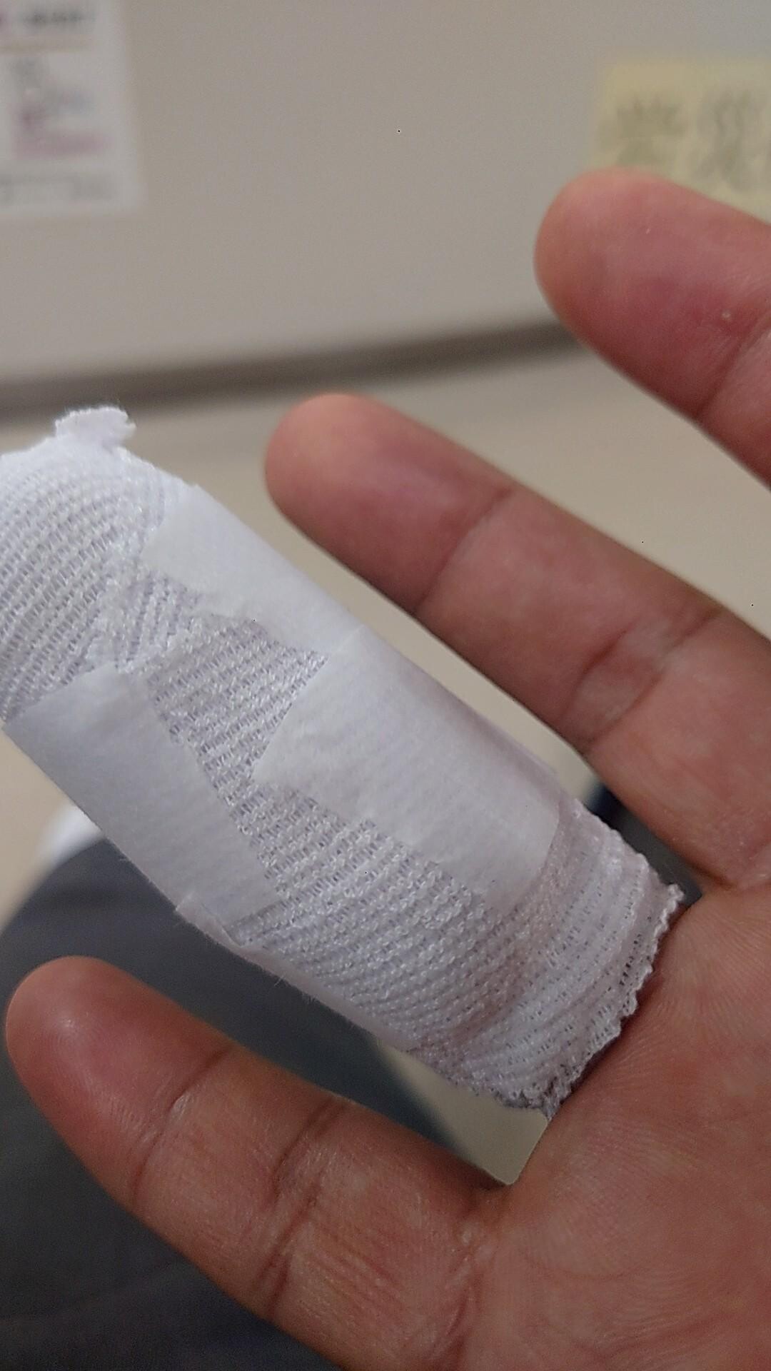 山では怪我したことないのに…下界で指骨折... / j.jack02さんのモーメント | YAMAP / ヤマップ