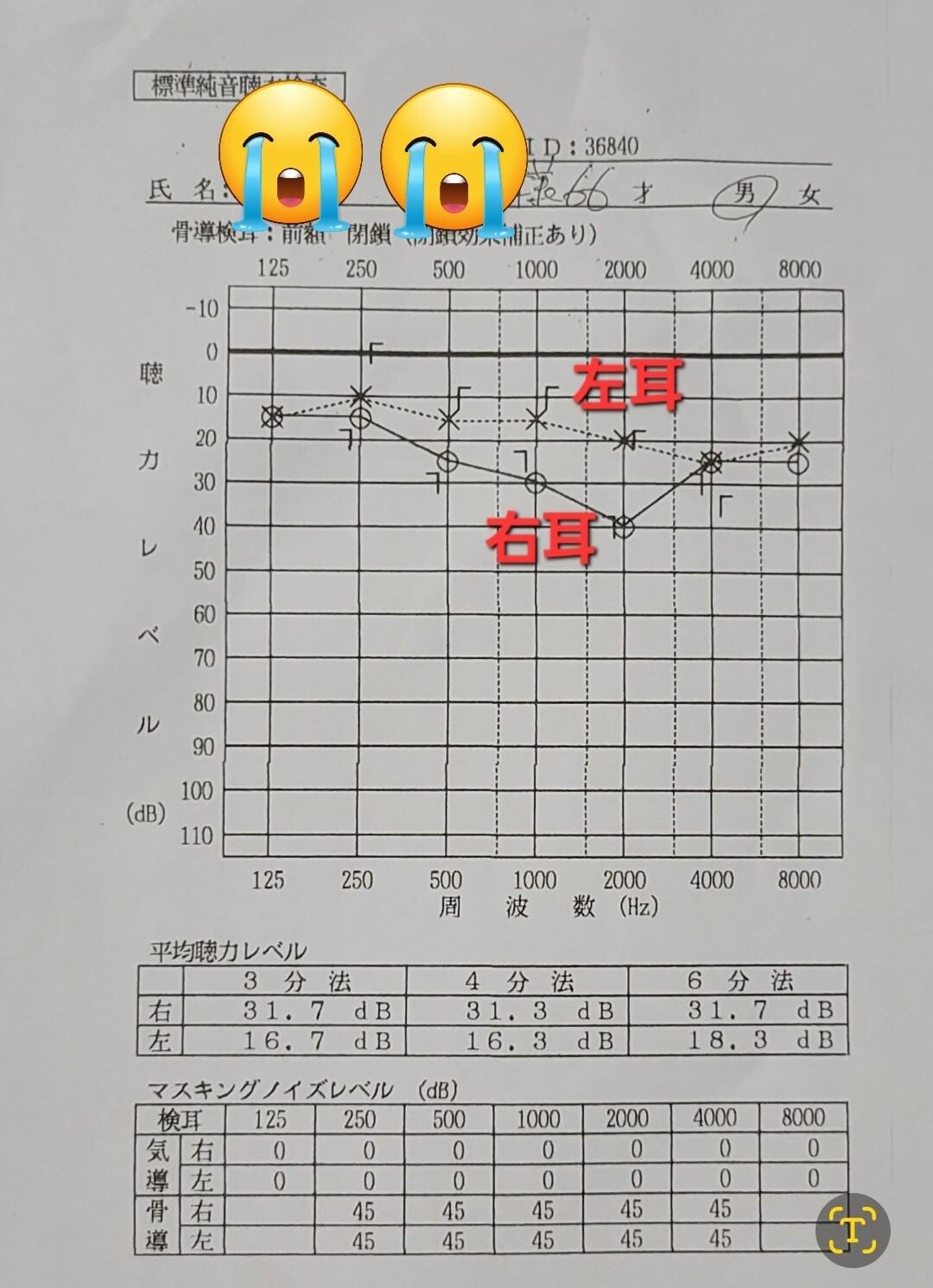 昨日(12/4)、朝起きると右耳👂️が... / 🧏‍♀️🚴アミちゃん🐐🐇さんのモーメント | YAMAP / ヤマップ