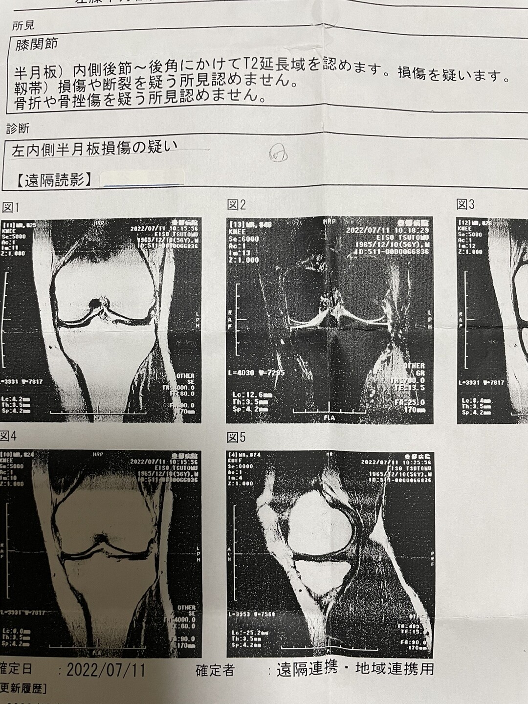 昨夕、MRI検査の結果を聞きに整形外科に... / えいっさんさんのモーメント | YAMAP / ヤマップ