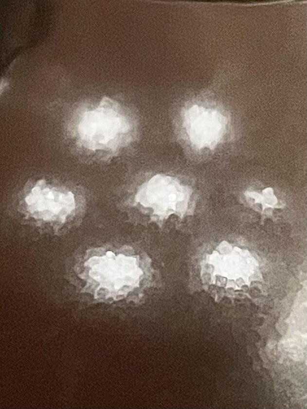 結晶 😉 crystal illum... / ミスターぽぽさんのモーメント | YAMAP / ヤマップ