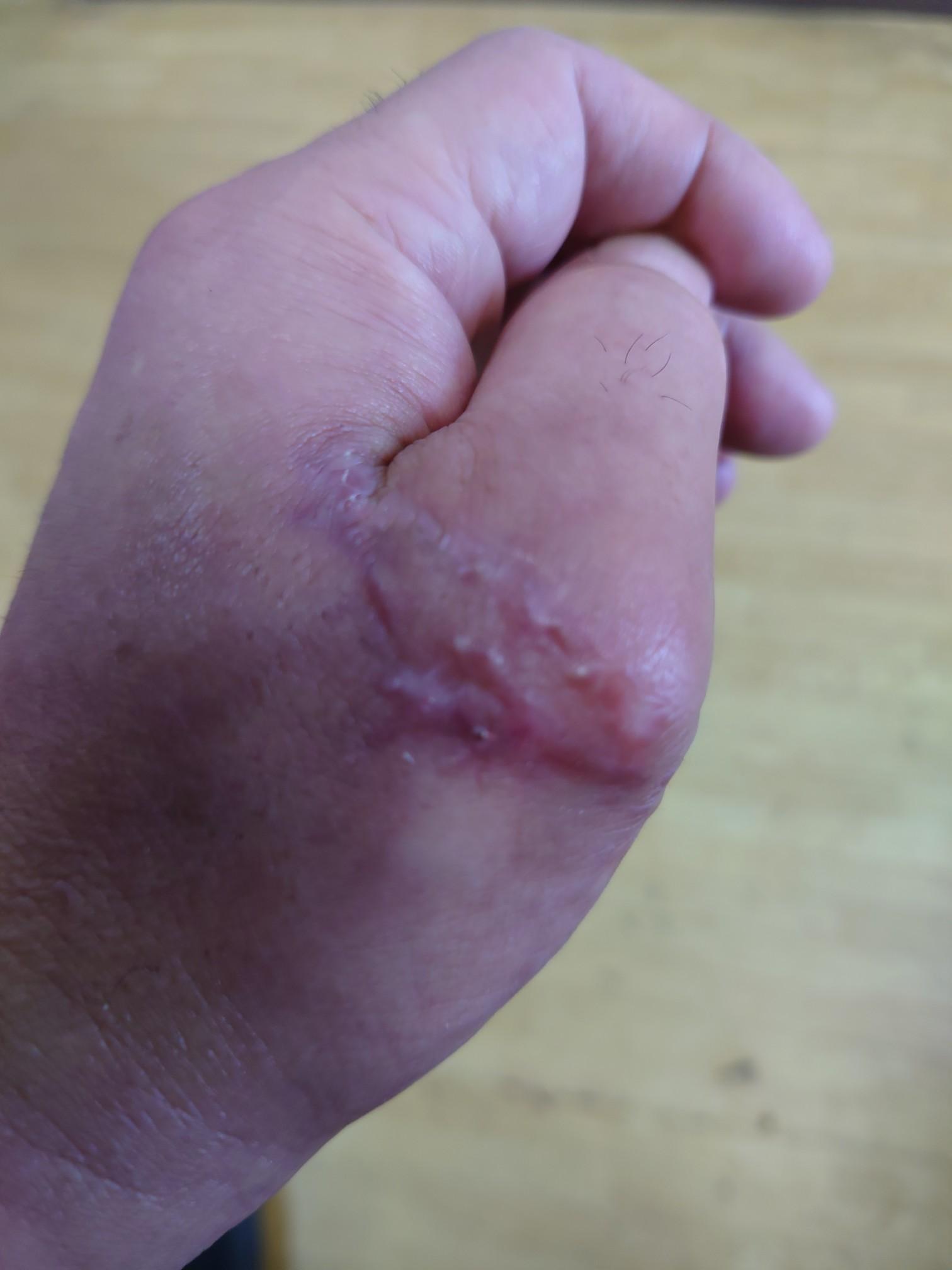 御心配お掛けしております 市民病院へ診察... / dewarsさんのモーメント | YAMAP / ヤマップ