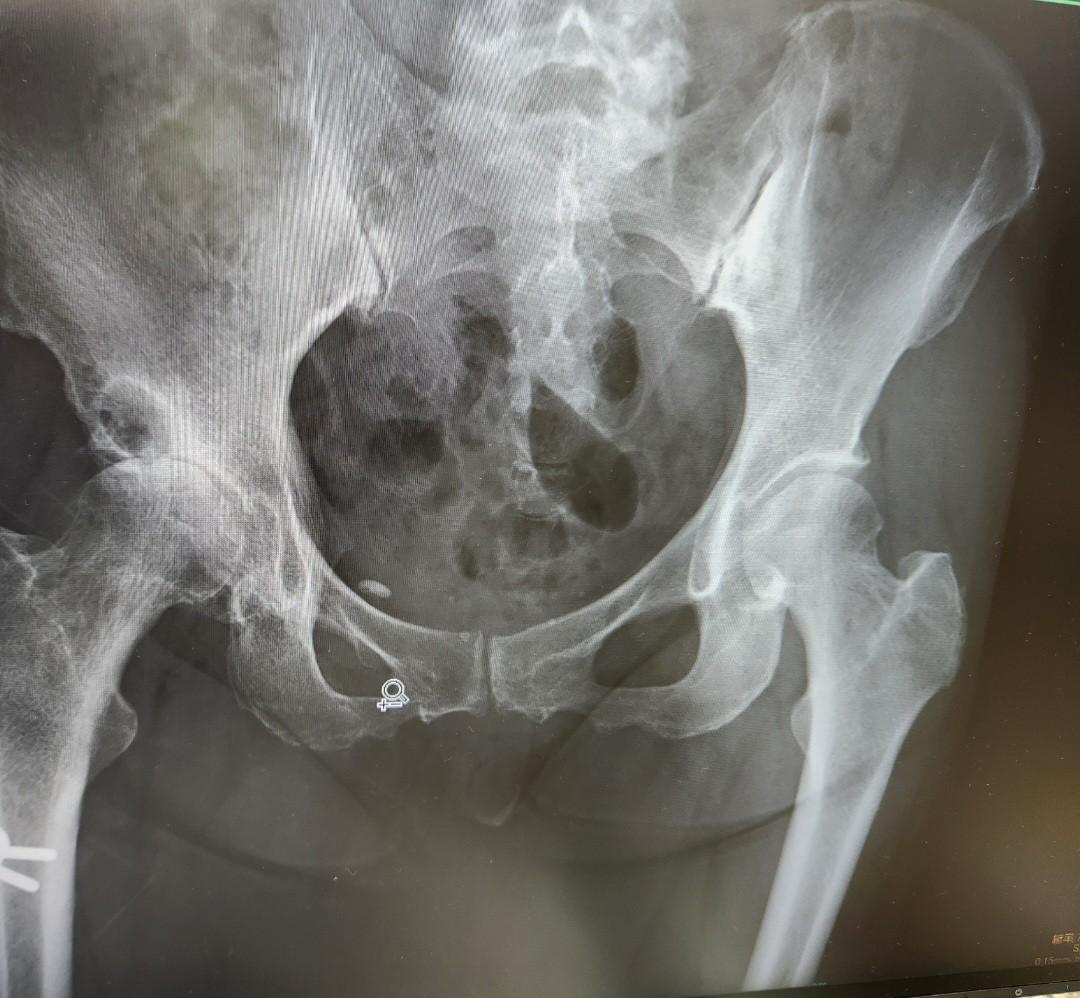 ヌーディな 写真出てきます 閲覧注意 昨... / かっかさんのモーメント | YAMAP / ヤマップ